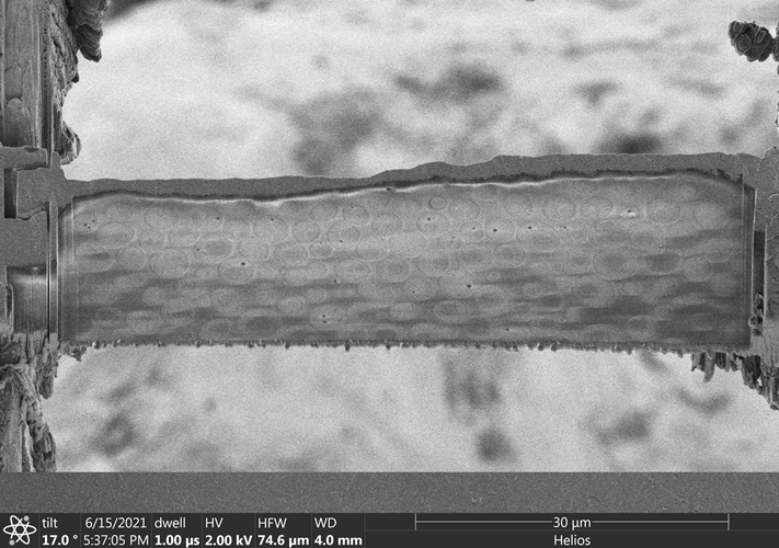 Cryo-Electron Tomography